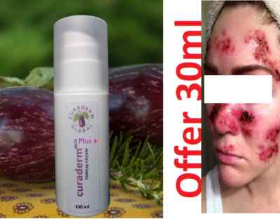 Curaderm BEC5 Plus+ Cream 30ml New Formula Full Spectrum ⭐ ORIGINAL ⭐ ...
