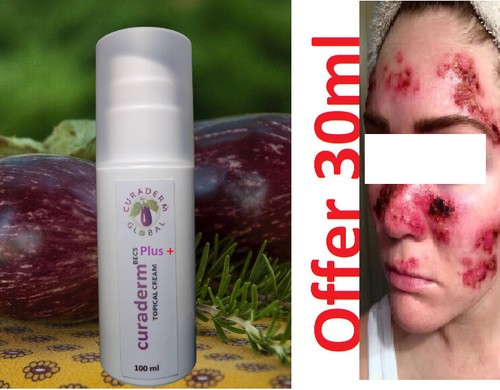 Curaderm BEC5 Plus+ Cream 30ml New Formula Full Spectrum . ⭐ ORIGINAL ⭐ ...