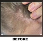 Trichology Re-balancing Scalp Hair Tonic, Healthy Scalp Healthy Hair ...