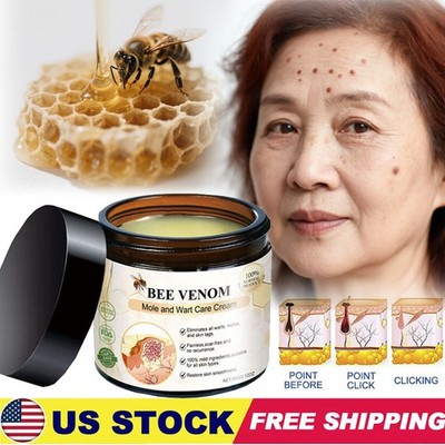 Bee Venom Skin Tag Removal Treatment Cream Body Care Mole Corn Wart ...