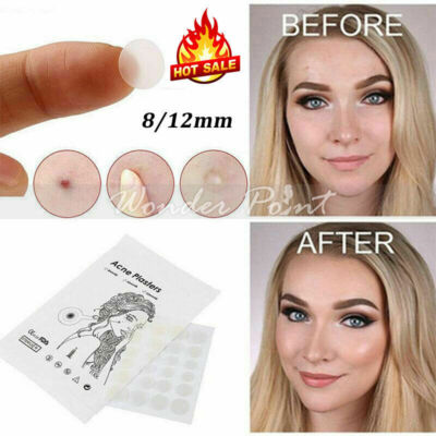 36pcs Acne Dots Pimple Patches Cystic Acne Patch Hydrocolloid Acne Spot ...