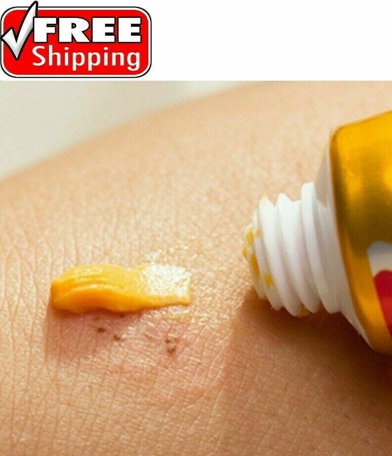 10PCS Psoriasis Dermatitis Eczema Ointment Treatment Skin Care Cream | eBay