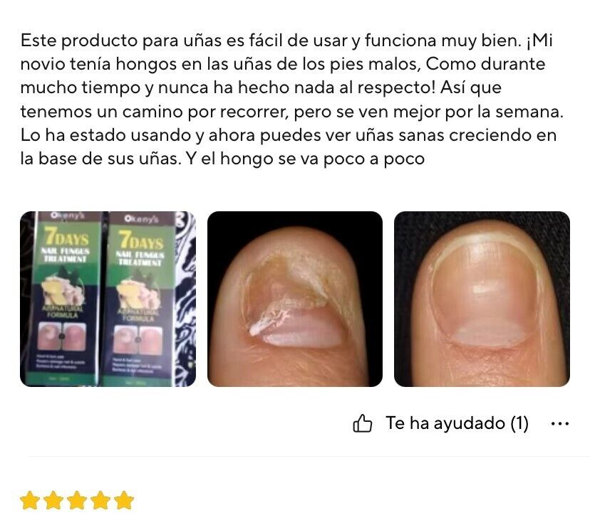 FUNGUS 7 DAYS NAIL FUNGUS TREATMENT ALL NATURAL FORMULA WITH GINGER AND ...