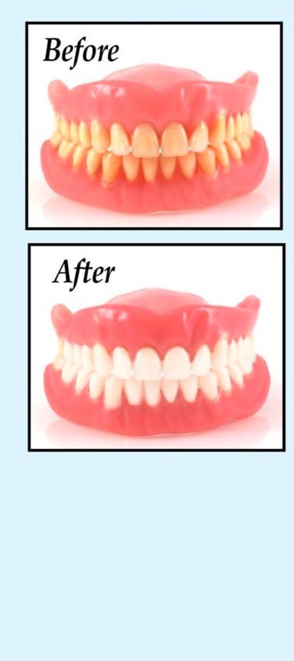 Sparkle-Dent Denture Whitener and Cleaner | eBay