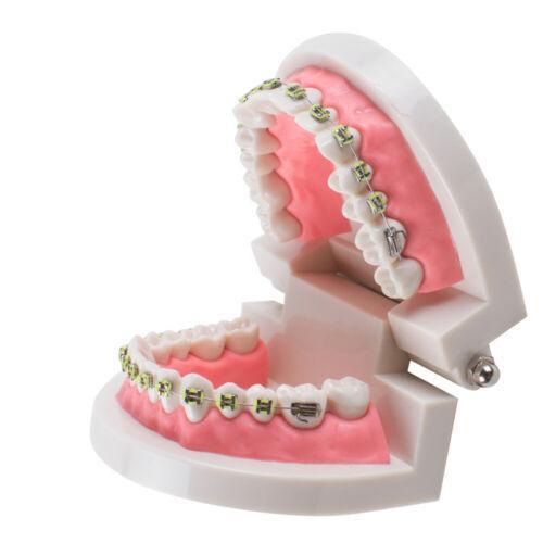 Advanced Dental Teeth Model Set with Brackets and Gum Guide for ...