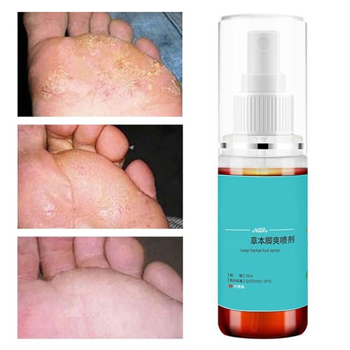 55ml Athlete's Foot Spray Liquid Smelly Feet Spray Foot Spray for Women ...