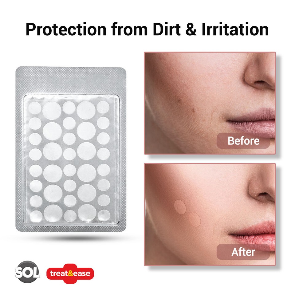 36 Cold Sore Patches Acne Spot Pimple Skin Breathable Blemish ...