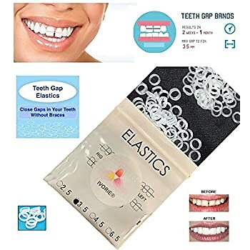 Teeth Gap Bands Cayenas Orthodontic Gap Teeth Bands 3/16"" Heavy 100