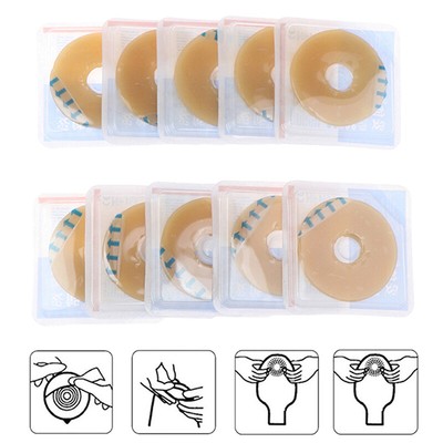 1Pc Ostomy Paste Ring Baseplates Stoma Care Leak-Proof Ring For Ostomy ...