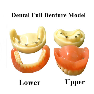 Dental Full Denture Model Overdenture Magnetic Attachment Mandibular ...
