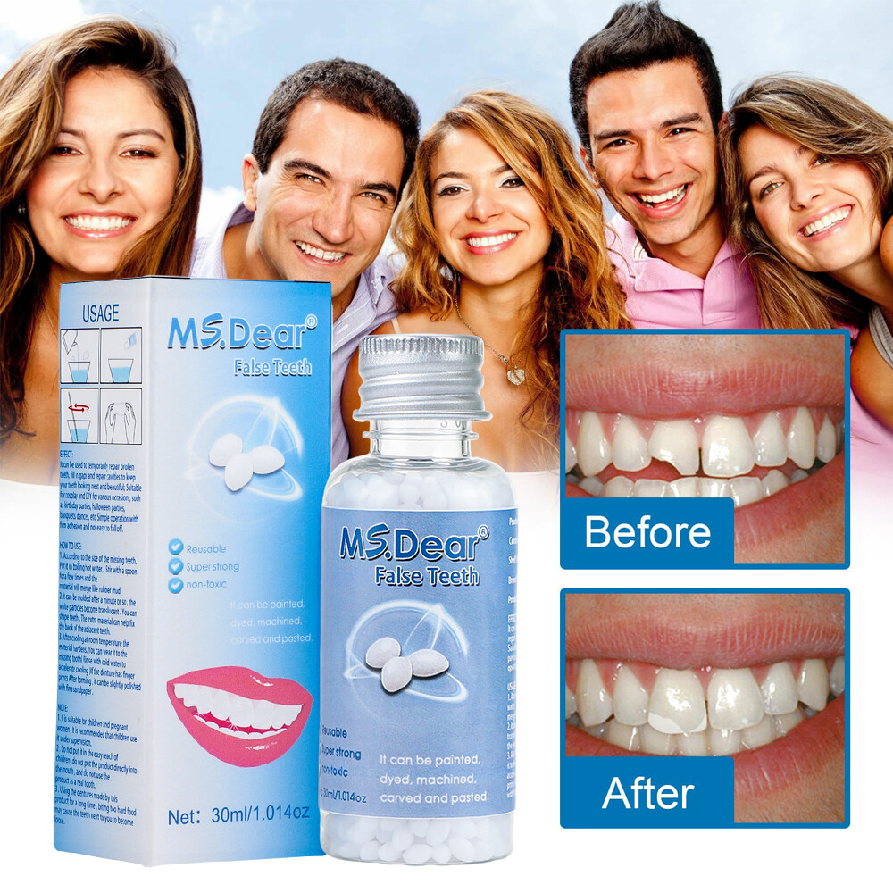 30ml MISSING TOOTH FILLER TEMPORARY COSMETIC REPLACEMENT REPAIR DIY ...