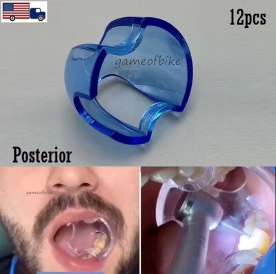 Dental Endodontic Mouth Opener Lip Cheek Retractor Expander Bite Props ...