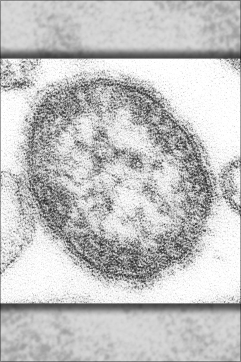 Rubeola Virus Microscope