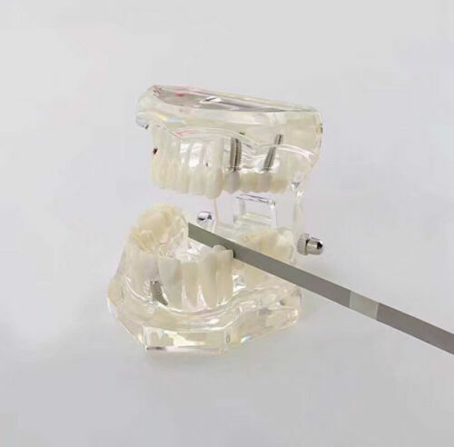 Dental Orthodontic Stainless Steel IPR Diamond Strips Single/Double ...