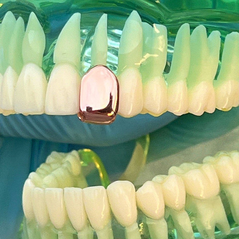 14K Rose Gold Plated Tooth Cap Real 925 Sterling Silver Single One ...