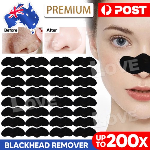UPTO 200x Blackhead Remover Nose Face Mask Strips Black Head Pore Acne ...