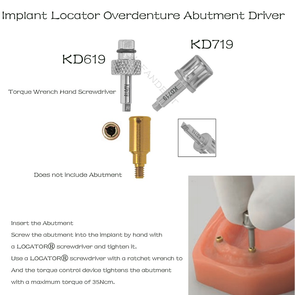 Locator Attachment Abutment Male Cap Inserts Tool for Straumann NC/RC ...
