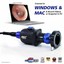 USB Endoscopy Camera Portable HD Medical for Storz Rigid Endoscope 1.2 ...