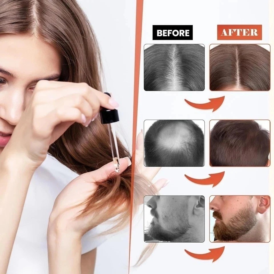 DHT Blocker Hair Serum Oil Organic DHT Blocker Biotin Repair Anti Loss ...
