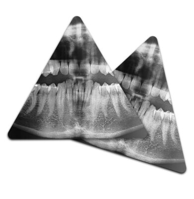 2x Triangle Coaster - BW - Dental Teeth X-Ray Dentist Dental #42795 | eBay