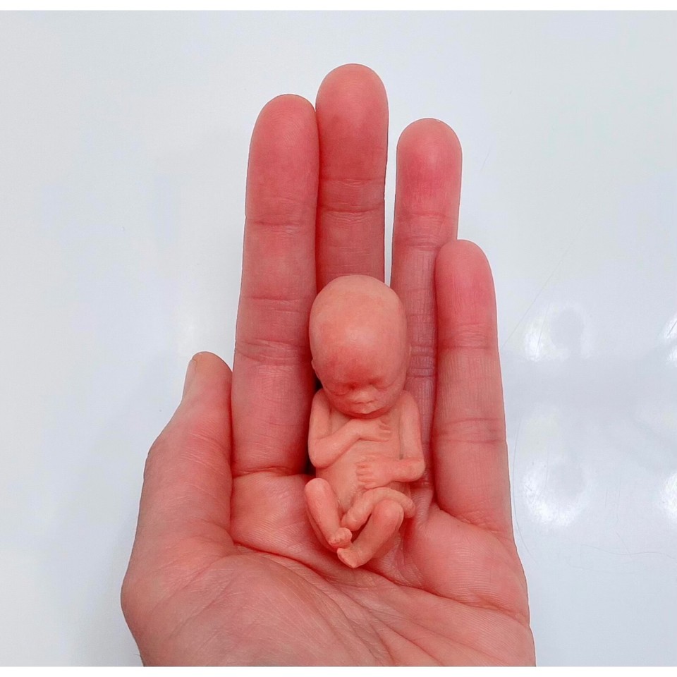 13 Weeks Baby Fetus, Stage of Fetal Development (Memorial/Miscarriage ...
