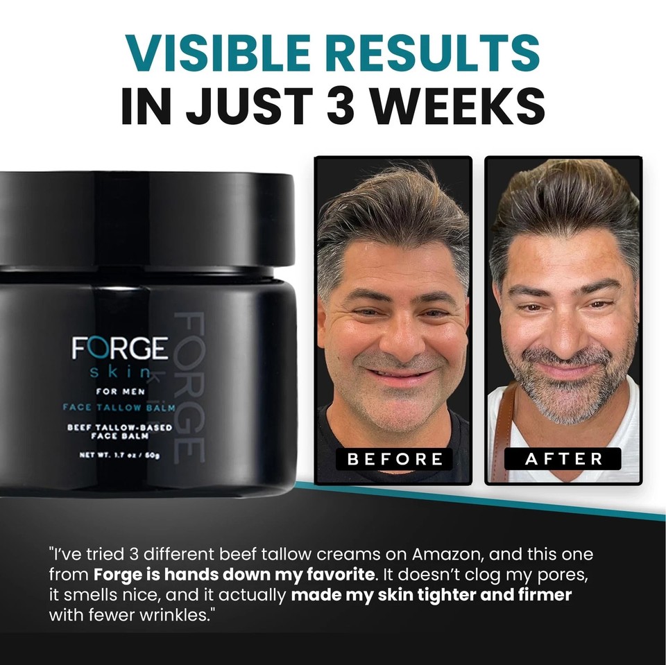 Forge Skin Men's Wrinkle Defense Beef Tallow Balm for Skin | Beef ...