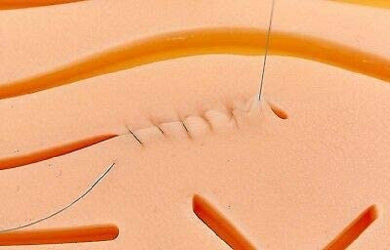 Large & Advanced Suture Training Practice Pad With Wounds 3 Layers 11 ...