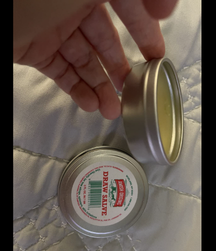 Balanitis Relief Cream All-Natural Gentle Soothing Skin Ointment For ...