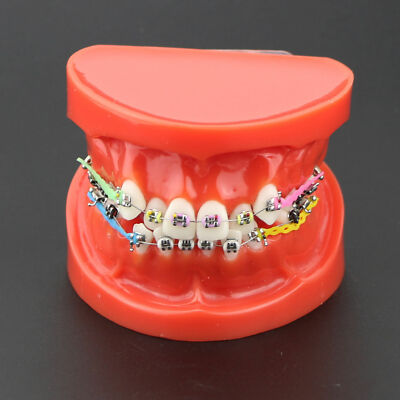 Dental Orthodontic Teeth Model With Bracket Chain Tie Arch Wire Buccal ...