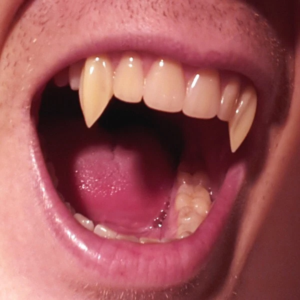 Real Vampire Fangs Dentist