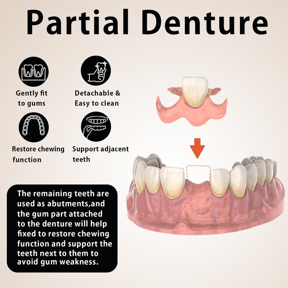 Custom Partial Dentures for Women with No Teeth, Temporary Dentures for ...