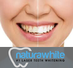 Naturawhite Teeth Whitening | eBay UK Stores