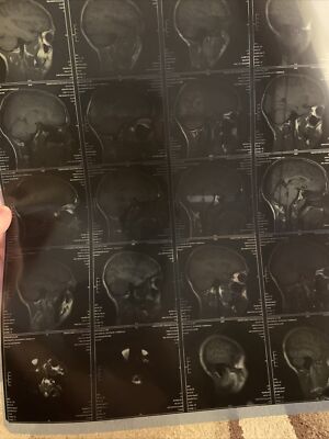 12x MRI X-RAY Film Sheet Brain Anatomy 12 Sheet Movie Prop RAB27 | eBay