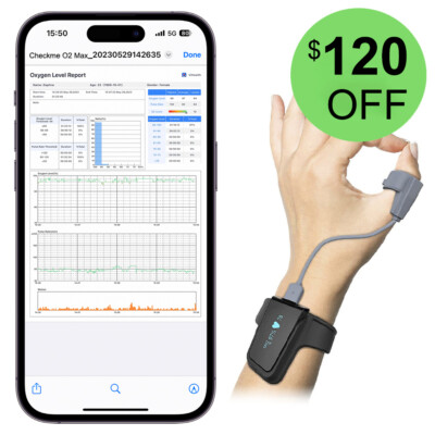 Refurbished Checkme O2 Max Pulse Oximeter O2 Sensor Ring Tracking SpO2 ...