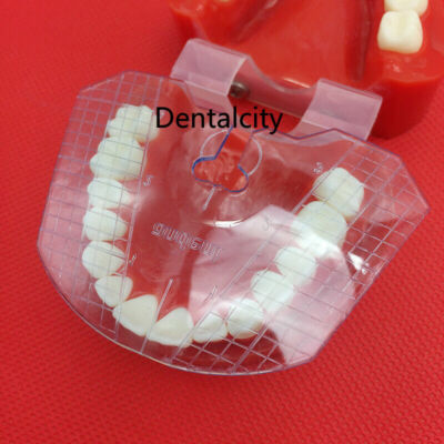 Orthopedic - Plate Set