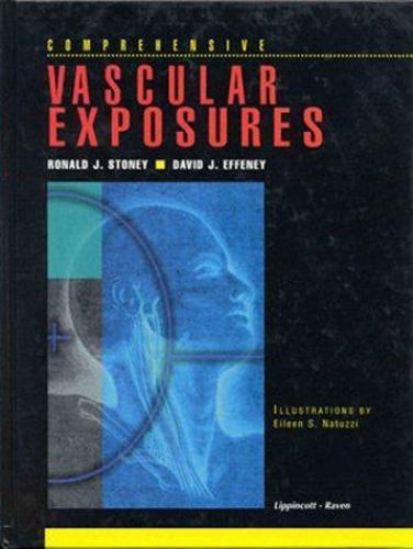 Comprehensive Vascular Exposures by David J. Effeney and Ronald J ...