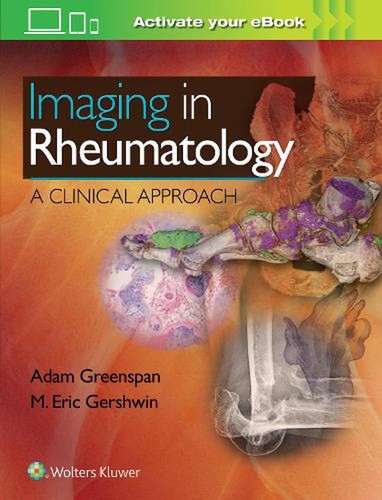 Imaging in Rheumatology: A Clinical Approach by Adam Greenspan (English ...
