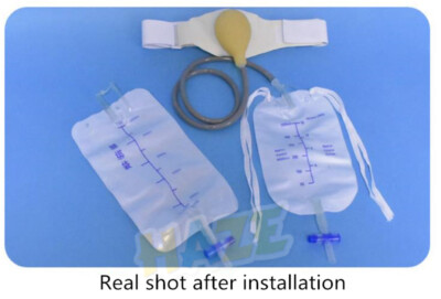 Night Use Bladder Full Cut Waist Belt Ostomy Urine Bag backflow Medical ...