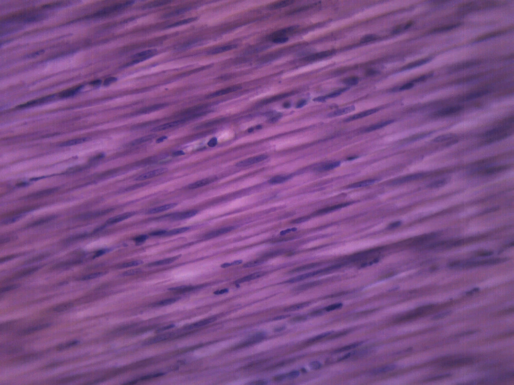 Smooth Muscle Slide