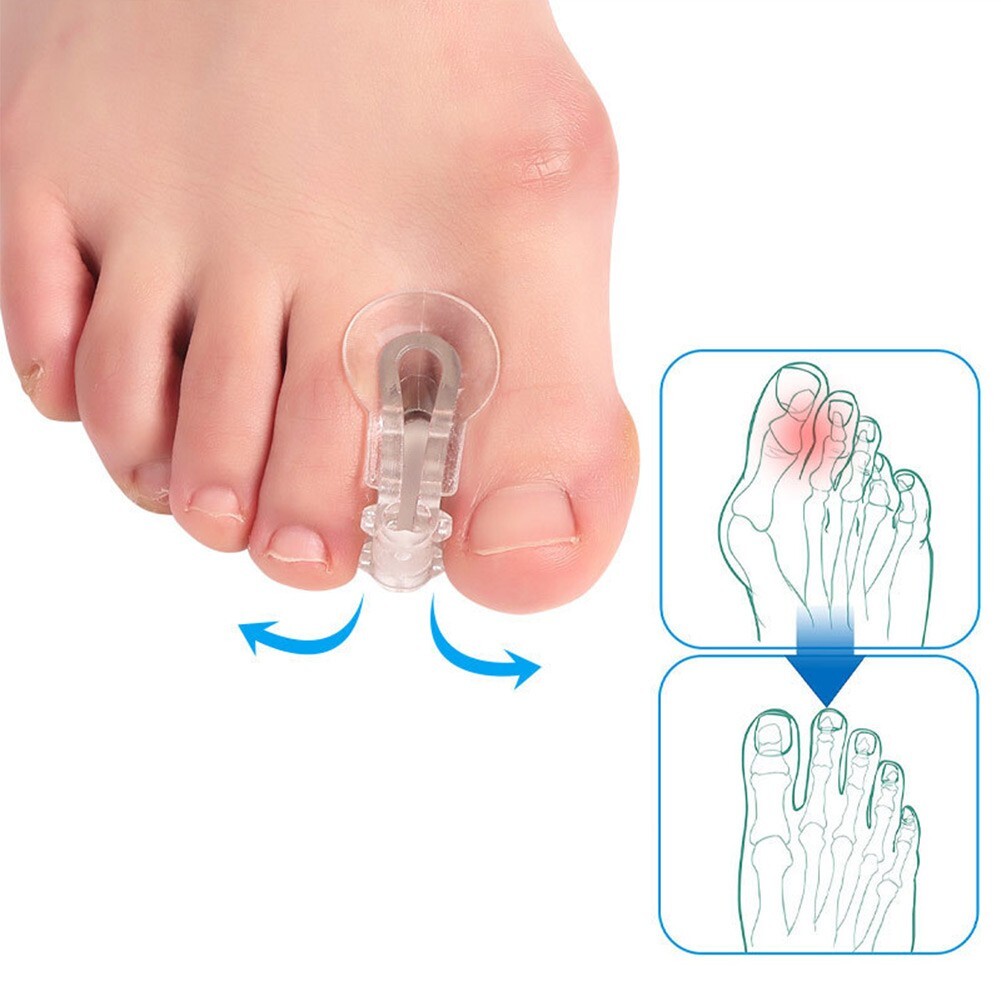 Toe Splitter Set Silicone Support Transparent 1pair Adhered Toe Big Toe ...