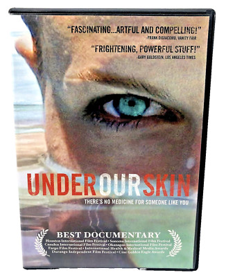 Under Our Skin (DVD, Documentary) Andy Abrahams Wilson | eBay