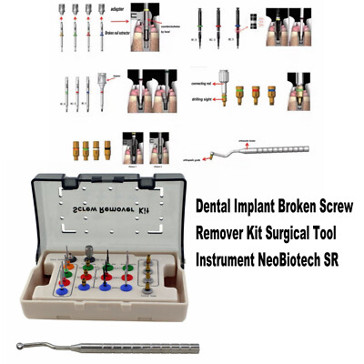 Dental Implant Broken Screw Remover Kit Surgical Tool Instruments ...