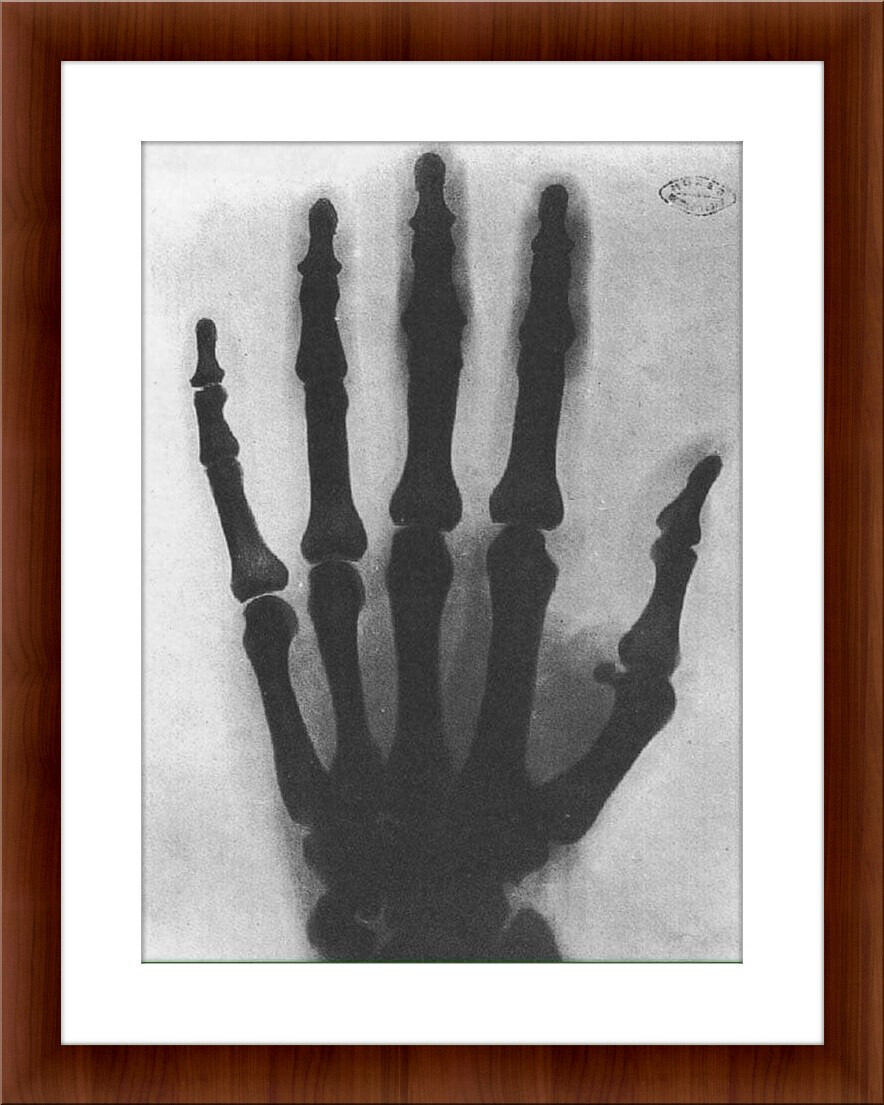 Nikola Tesla Hand X Ray Roentgen Ray Photo Wall Art | eBay