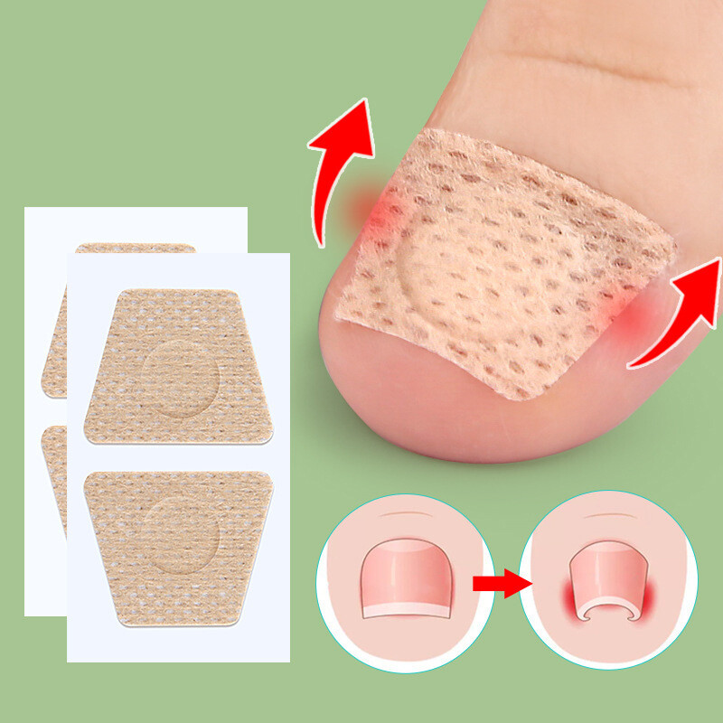Nail Care Patch Ingrown Toenail Pad Orthopedic Patch Soft Nail Repair ...