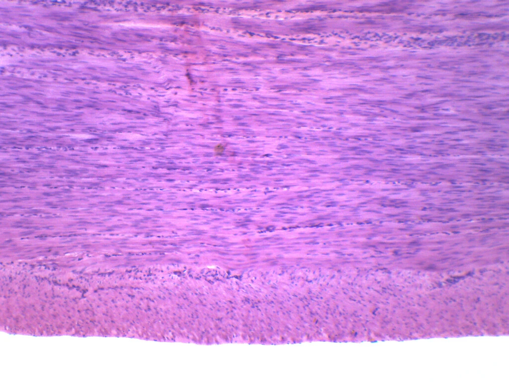 Smooth Muscle Slide Labeled