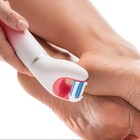 4 Pcs Foot File Replacement Rollers Heads Coarse Essy Premium | eBay