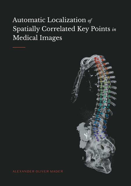 Automatic Localization of Spatially Correlated Key Points in Medical ...