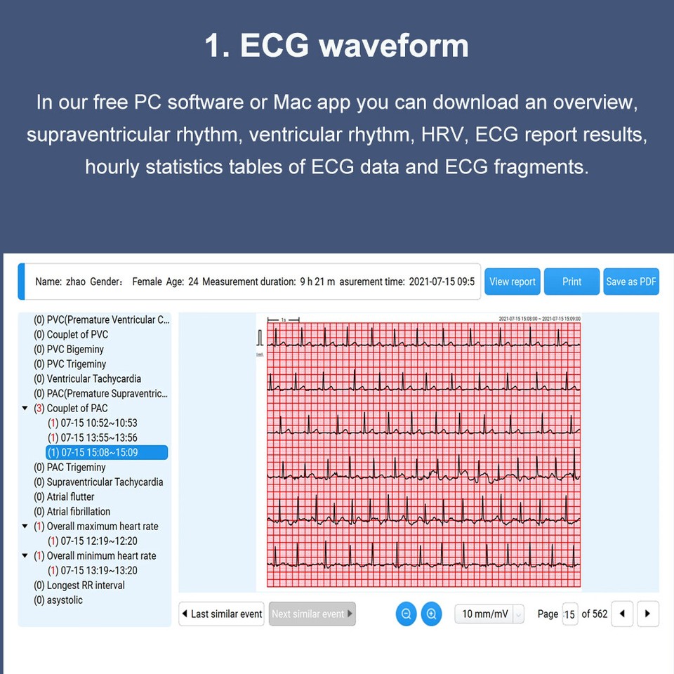 24 hours ECG/EKG Holter Monitor System with AI analysis Detects Afib PC ...