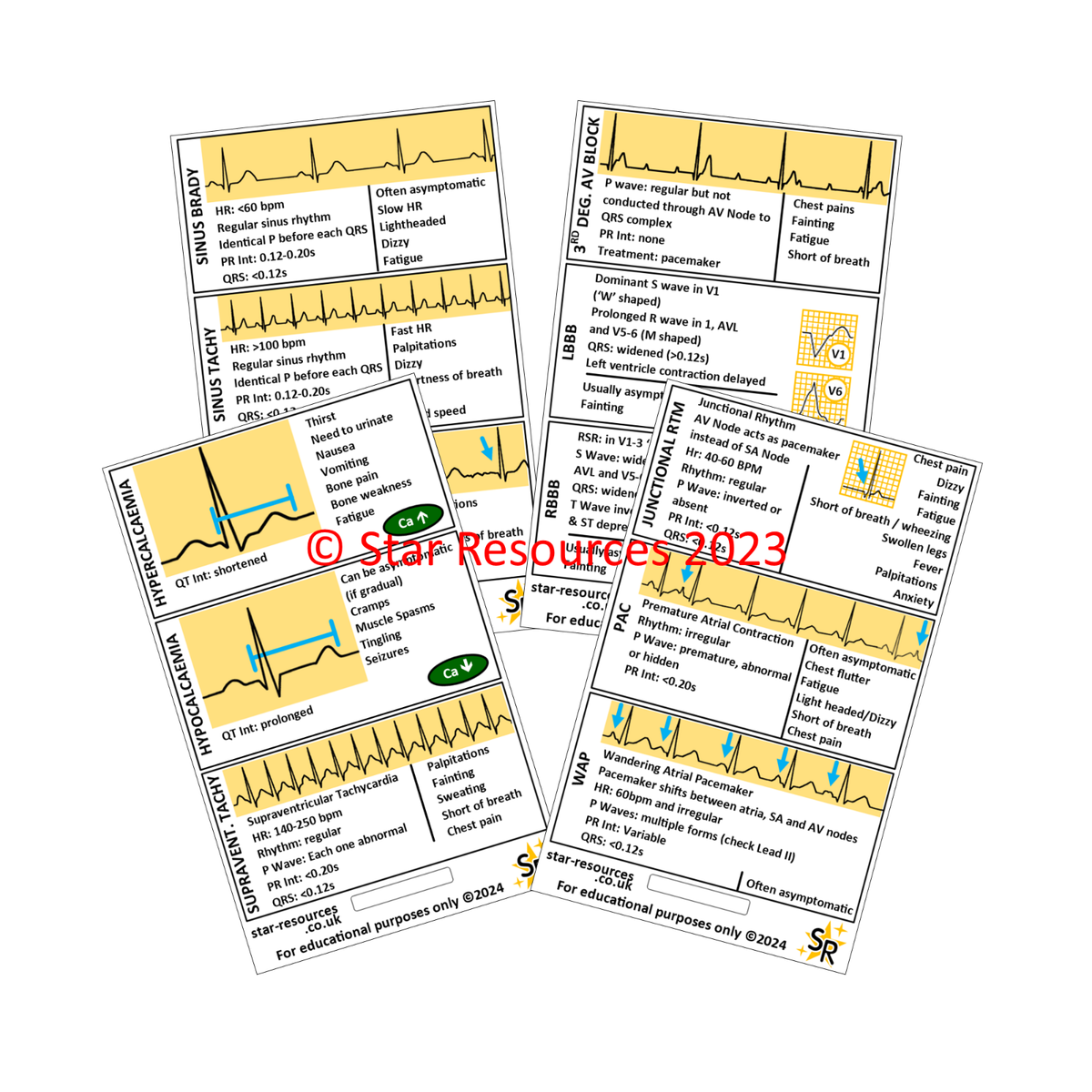 Heart Rate Monitor 1PC ECG/EKG Rhythm Pocket Card Double Sided EKG ...