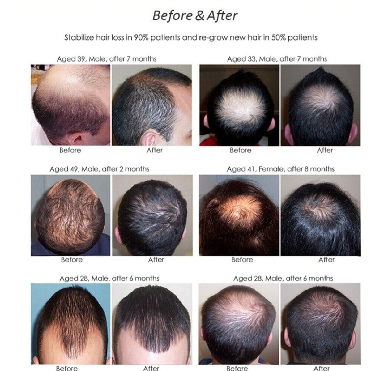 Red Light Therapy Hair Regrowth Searching For Ways To Optimize Your